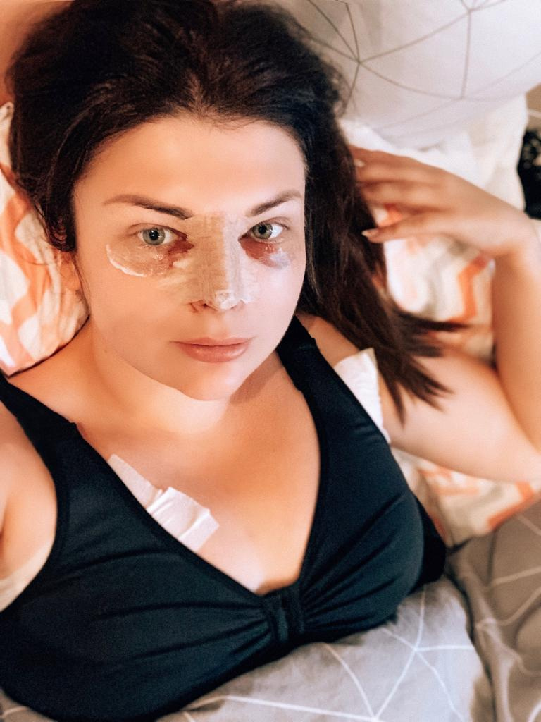 Модель plus-size Юлия Рыбакова уменьшила грудь и сделала ринопластику | StarHit.ru